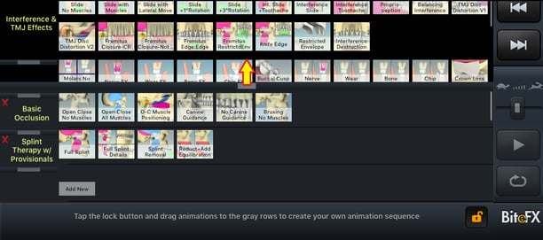Helpful Hints Using BiteFX for iPad - V3.1